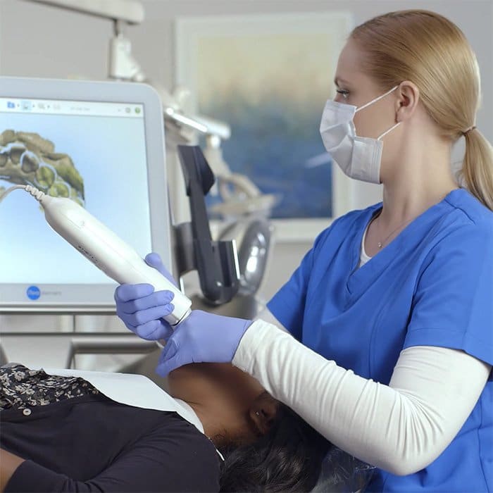 Goodbye Impressions, Hello iTero Scanner - All About You Dental Care ...